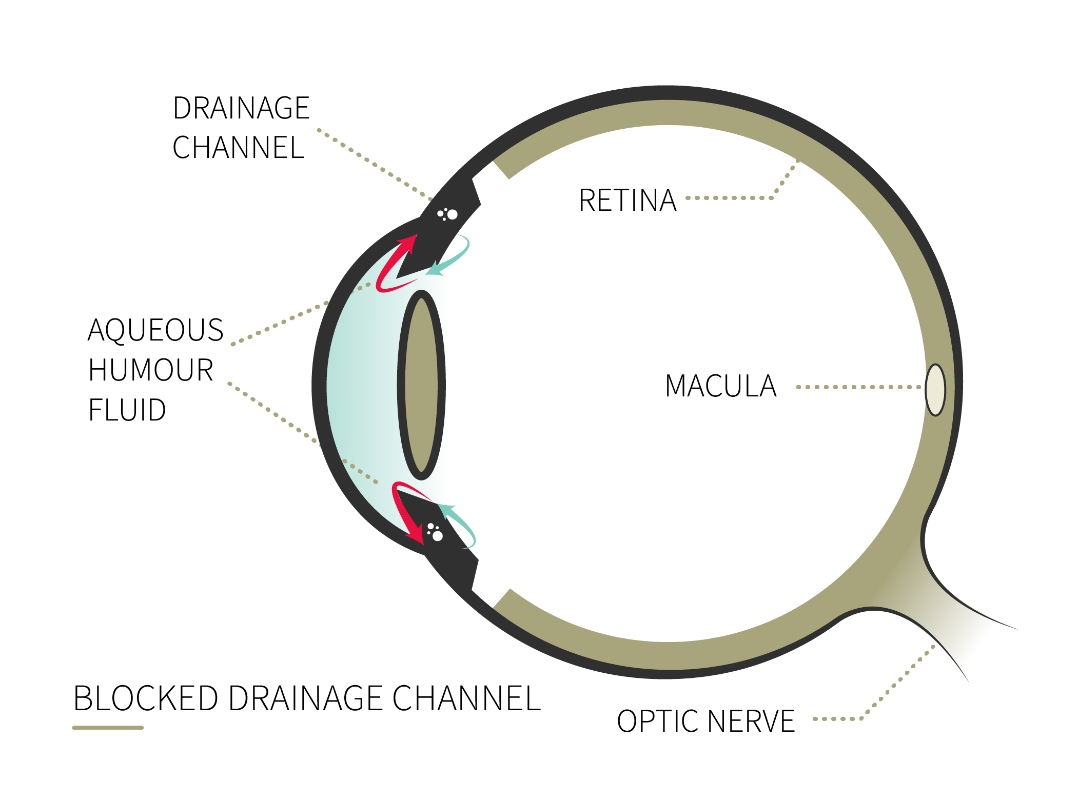 Glaucoma | symptoms and treatments - Clínica Rahhal