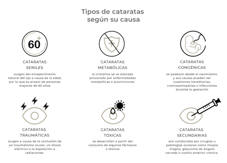 Cataratas: Qué son, tipos, síntomas y tratamiento