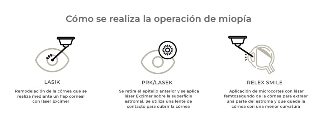 Todo lo que debes saber antes de operarte de miopía