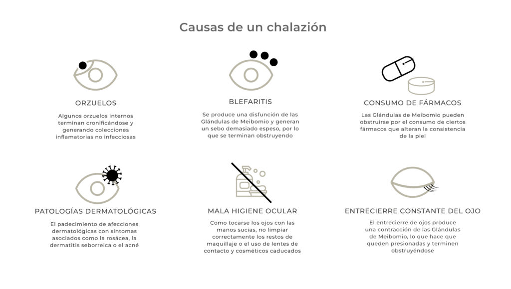 Chalazión: Qué es, causas y tratamiento - Clínica Rahhal