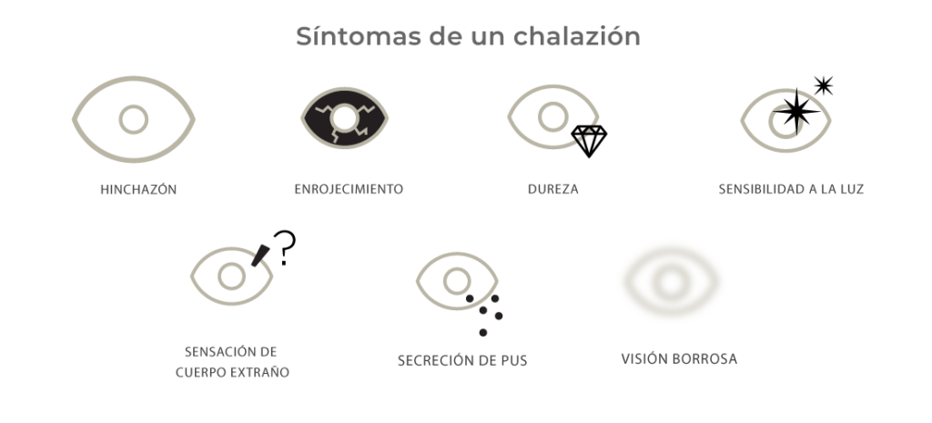 Chalazión: Qué es, causas y tratamiento - Clínica Rahhal