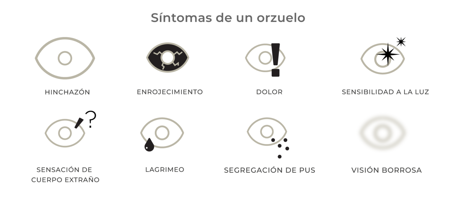 Orzuelo: Qué es, causas y tratamiento - Clínica Rahhal