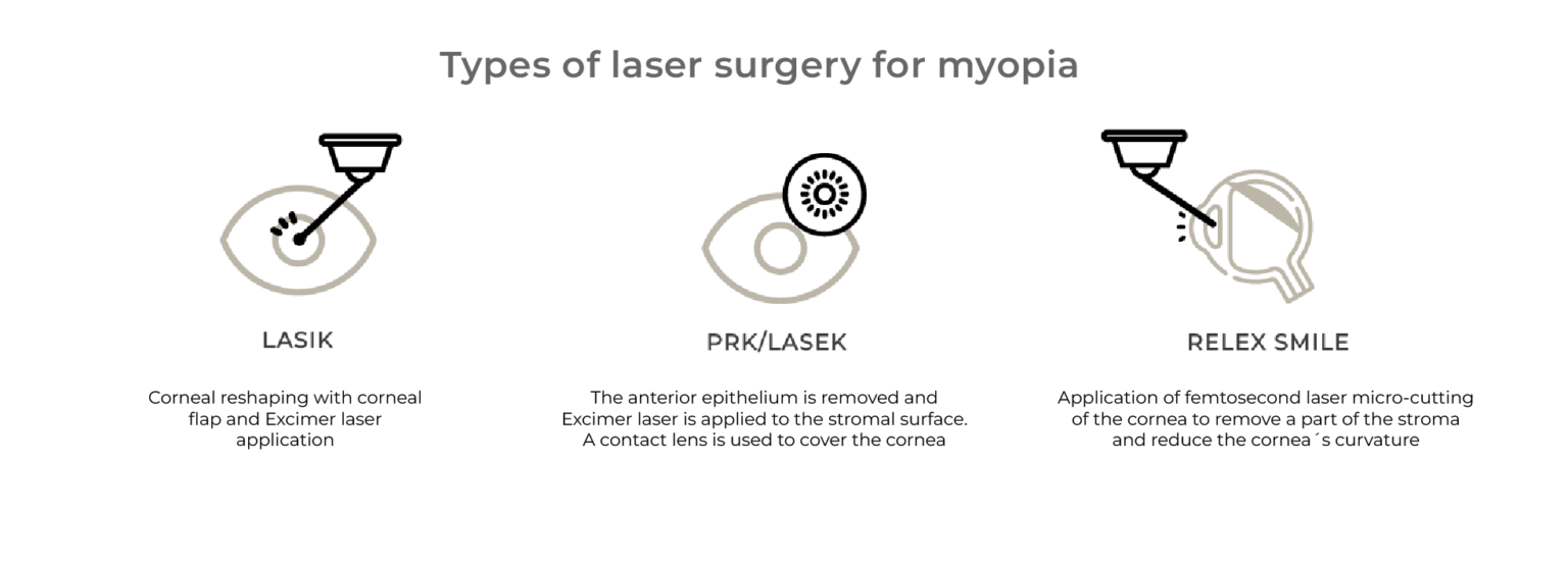 Laser eye surgery for myopia in Valencia - Clínica Rahhal